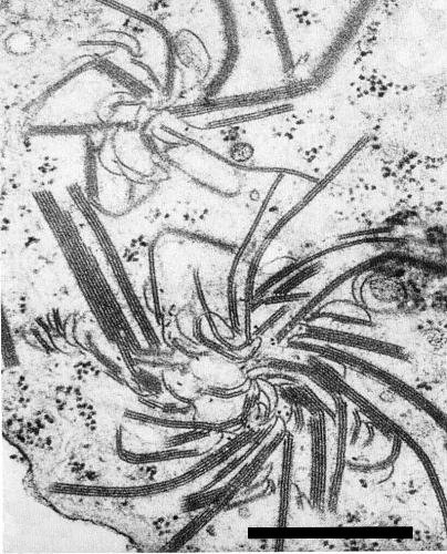 Details of DPV Tobacco etch virus and References