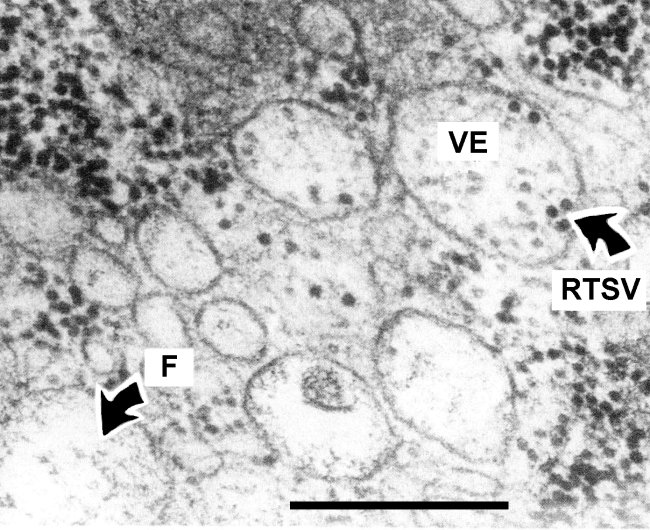 Details of DPV Rice tungro spherical virus and References